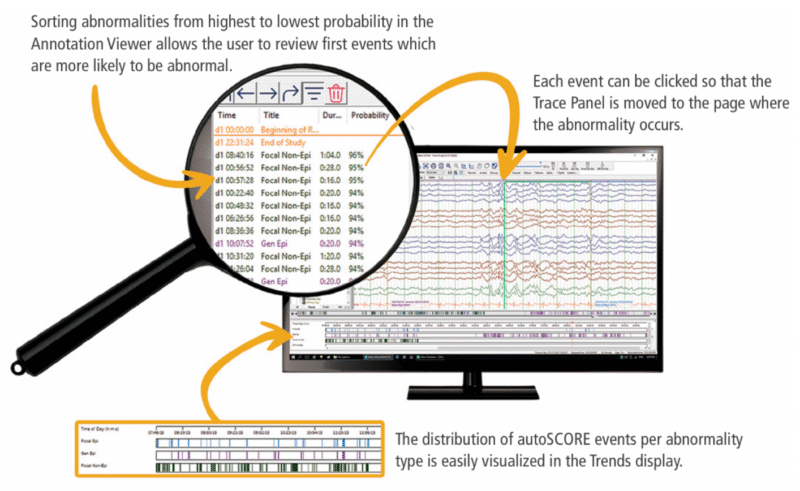 Natus® XLTEK EEG32U™ – PraxisMed Technologies Inc.